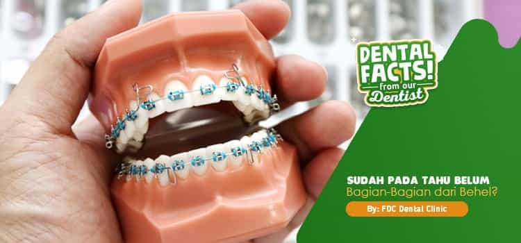 Sudah Pada Tahu Belum Bagian-Bagian Behel?